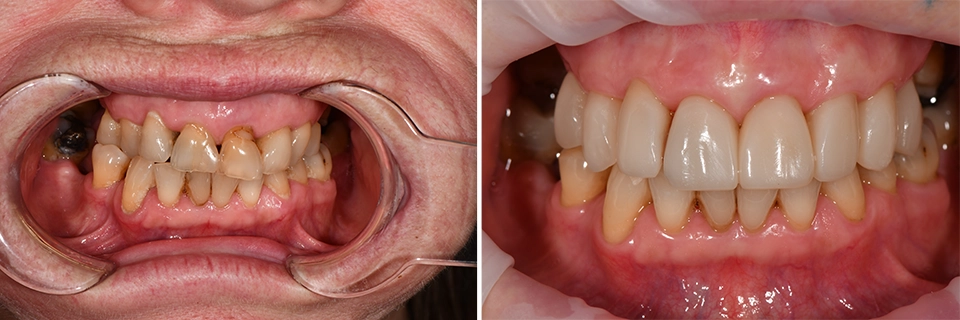 Before and After | Contemporary Smiles Dental